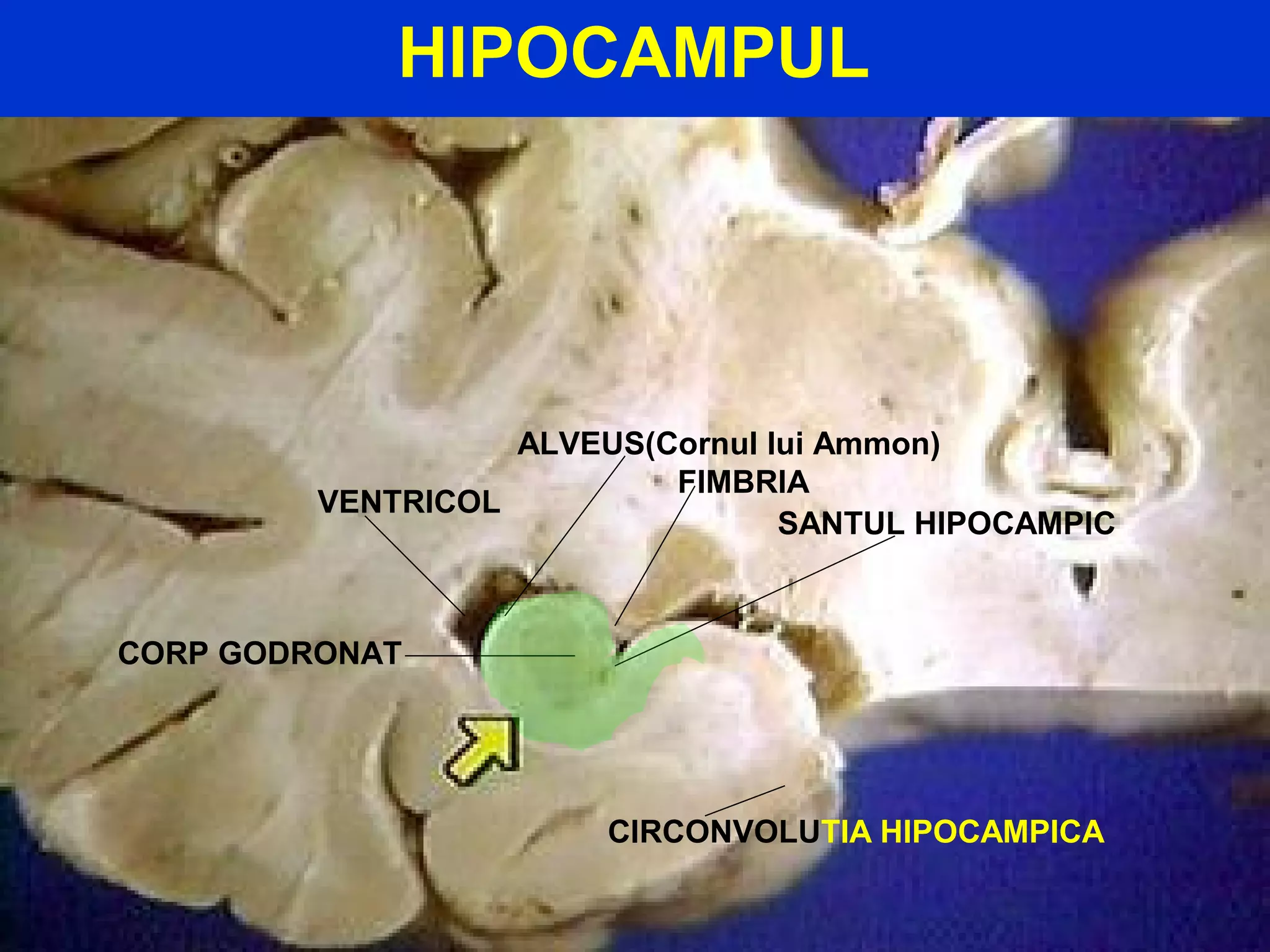 Sistemul limbic atlas de neuroanatomie | PPT