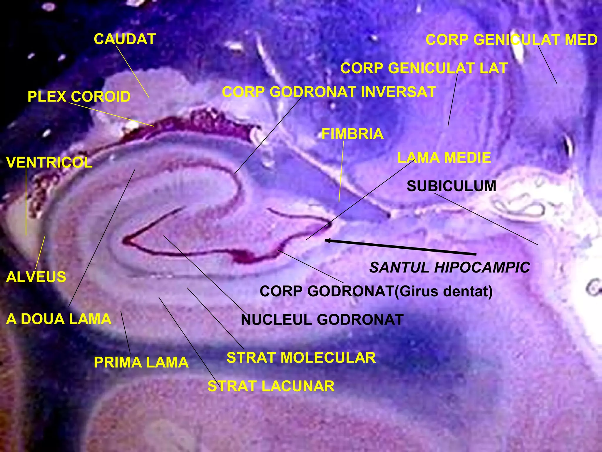 Sistemul limbic atlas de neuroanatomie | PPT
