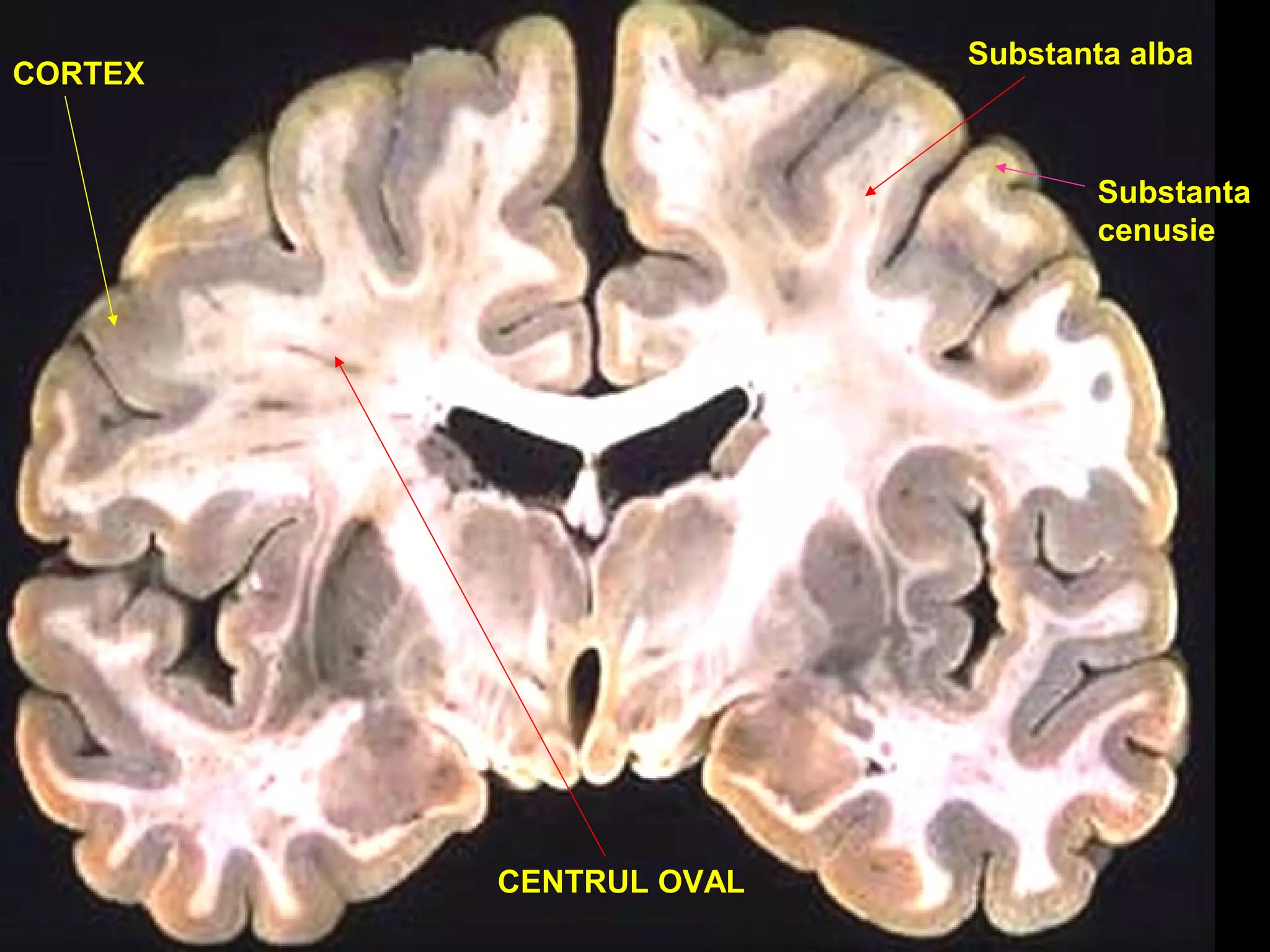 Cortex atlas de neuroanatomie | PPT | Free Download