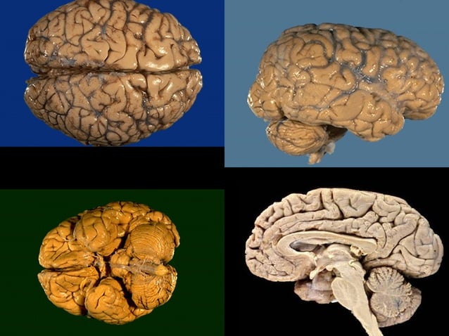 Cortex atlas de neuroanatomie | PPT