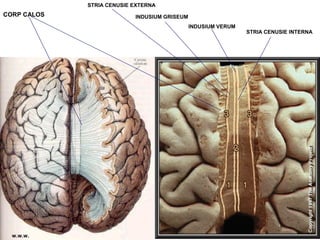 Cortex atlas de neuroanatomie | PPT