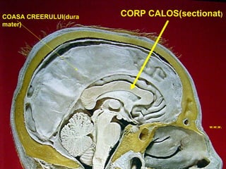 Cortex atlas de neuroanatomie | PPT