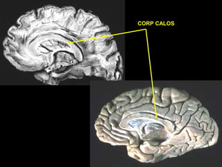 Cortex atlas de neuroanatomie | PPT