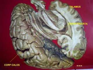 Cortex atlas de neuroanatomie | PPT