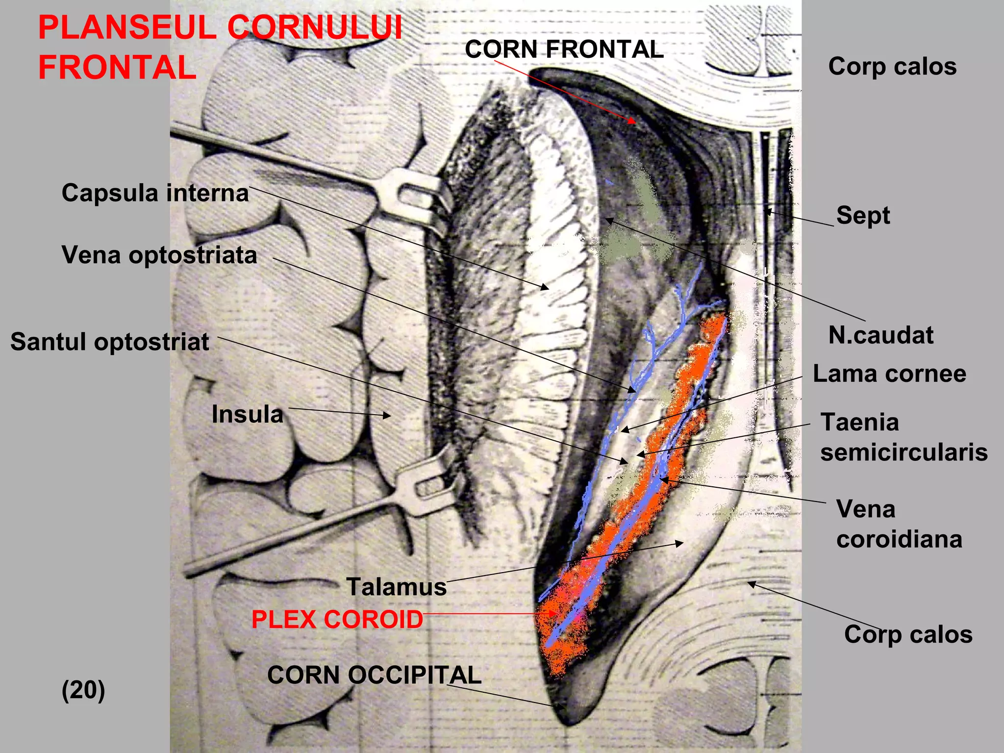 Atlas de neuroanatomie - Ventriculi cerebrali | PPT