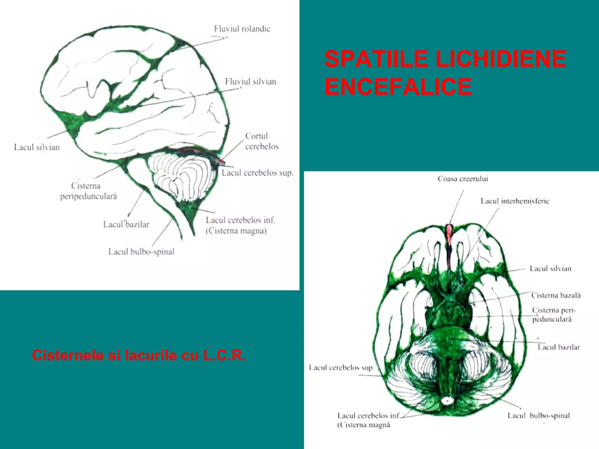 Atlas de neuroanatomie - Ventriculi cerebrali | PPT
