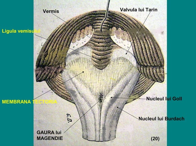 Atlas de neuroanatomie - Ventriculi cerebrali