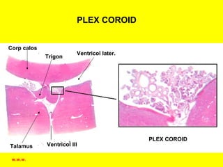Atlas de neuroanatomie - Ventriculi cerebrali | PPT