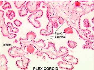 Atlas de neuroanatomie - Ventriculi cerebrali | PPT