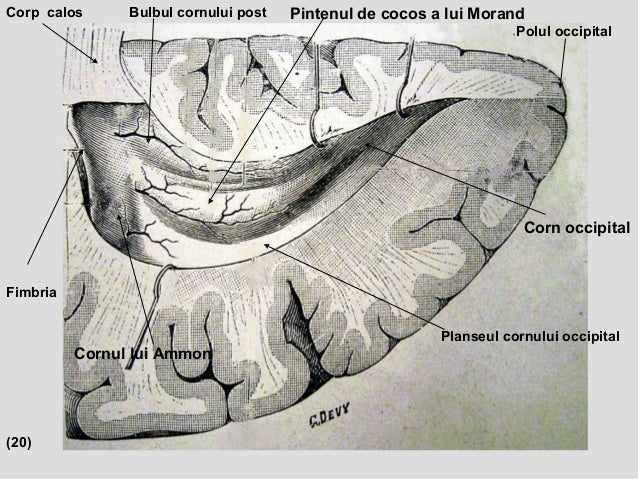 Atlas de neuroanatomie - Ventriculi cerebrali