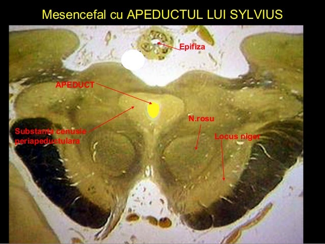 Atlas de neuroanatomie - Ventriculi cerebrali