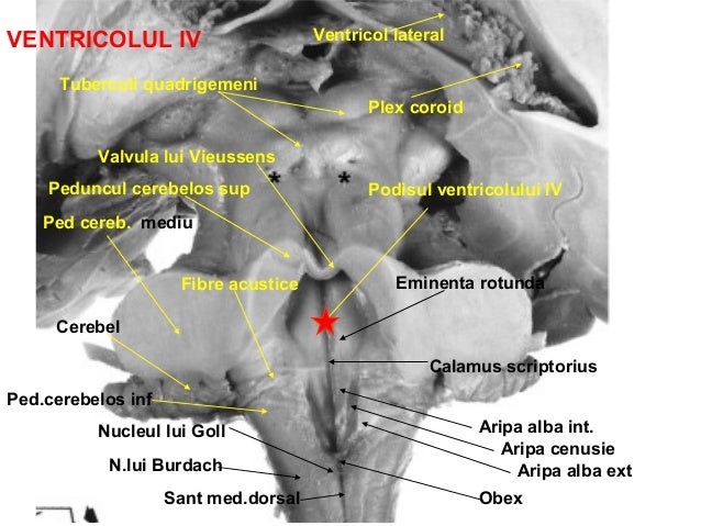 Atlas de neuroanatomie - Ventriculi cerebrali
