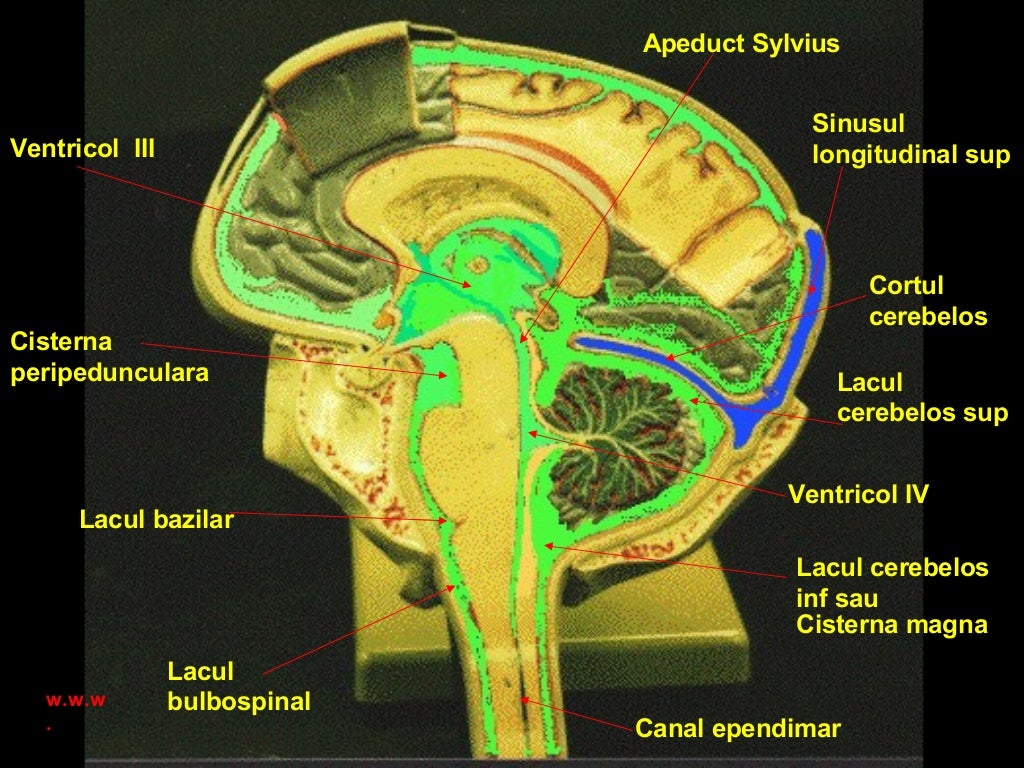 Atlas de neuroanatomie - Ventriculi cerebrali