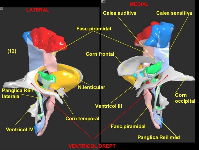 Atlas de neuroanatomie - Ventriculi cerebrali