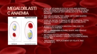 Anemia physiology for MBBS students .pdf