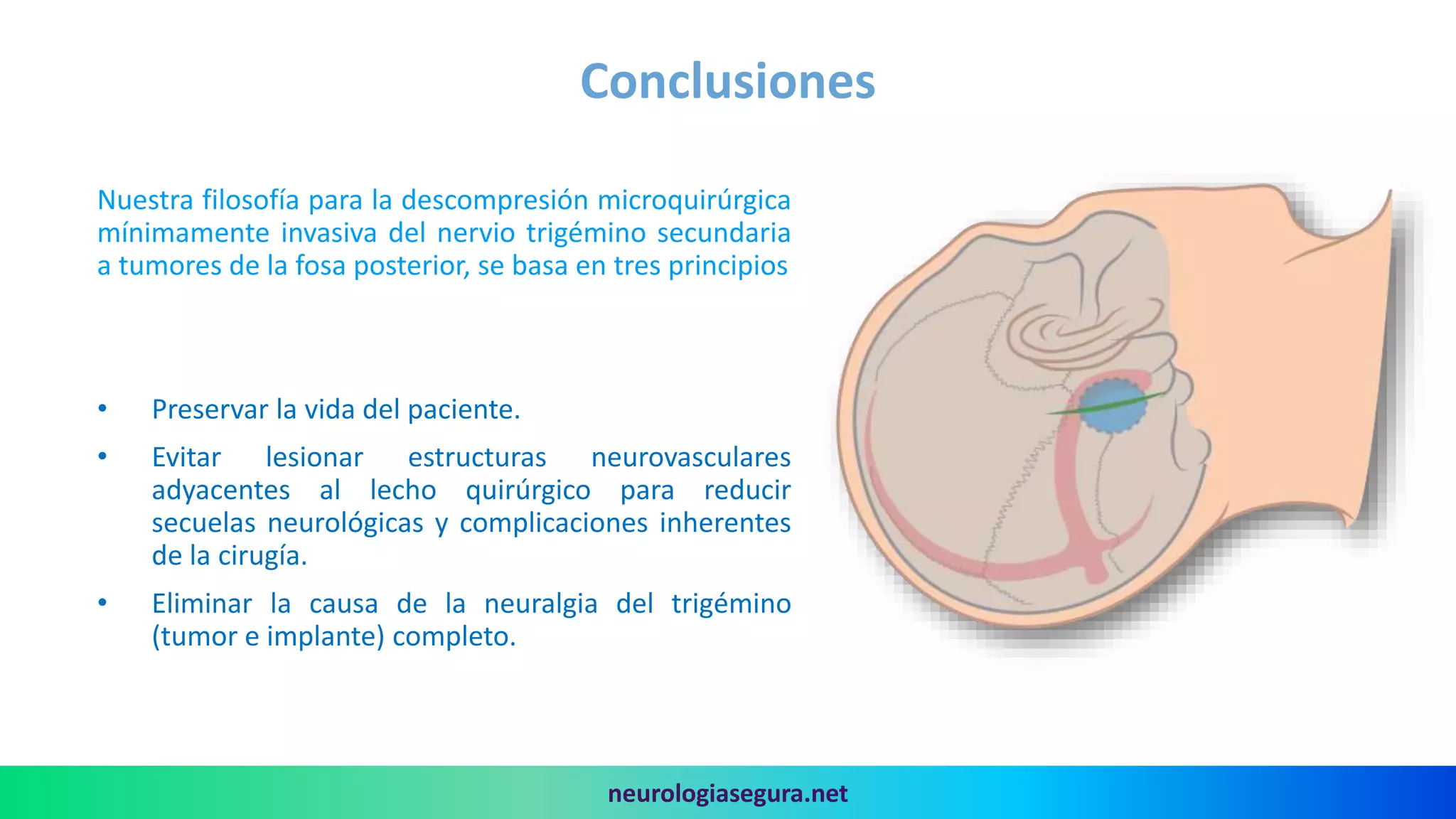 Quiste epidermoide de fosa posterior serie de casos SCNO A2022 0715 | PPT