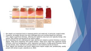 ILMU PENYAKIT MULUT TINGKAT LANJUT PPDGS IPM FKG UNAIR Burn Lesions ...