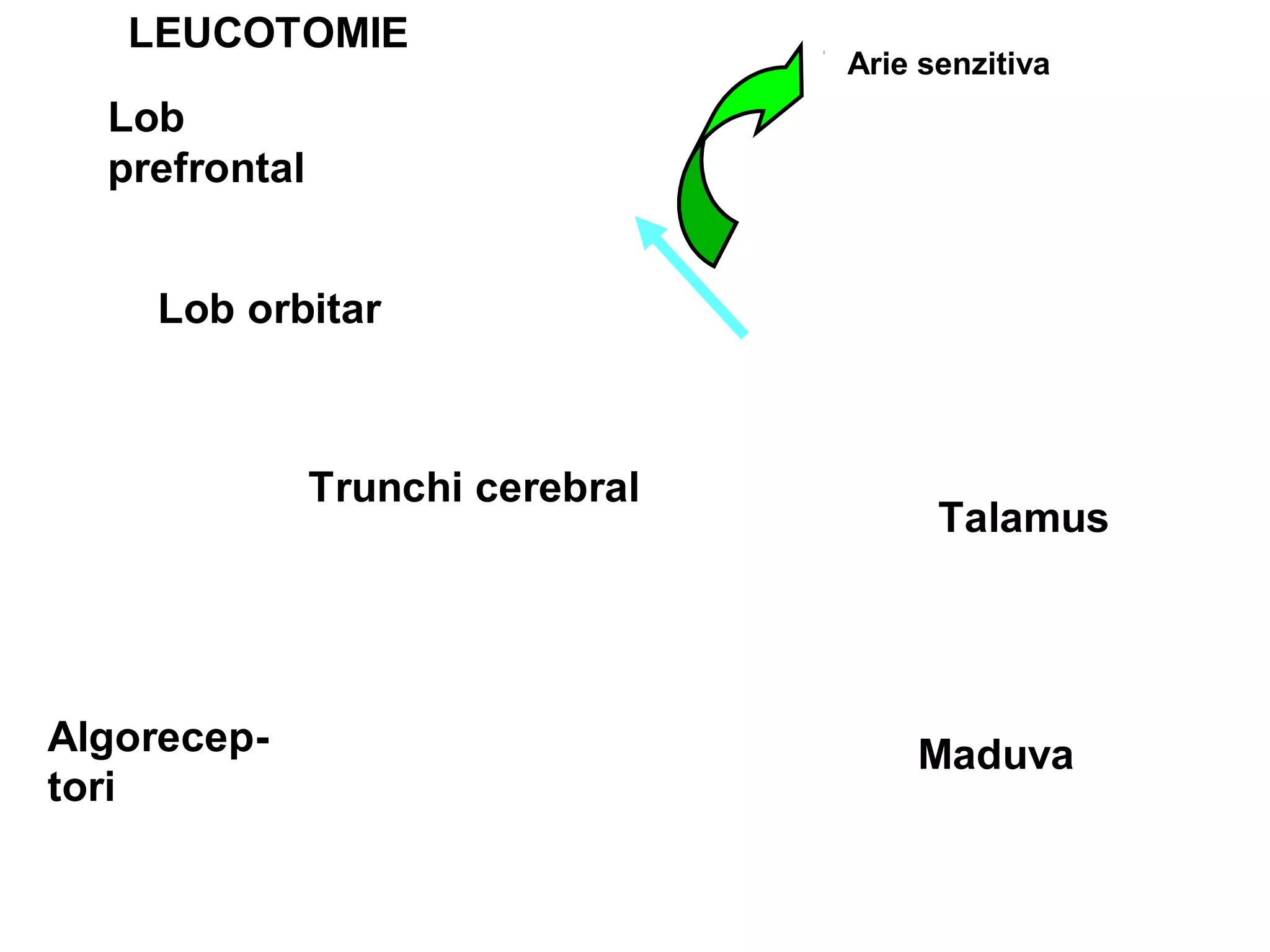 Atlas de neuroanatomie Calea durerii | PPT