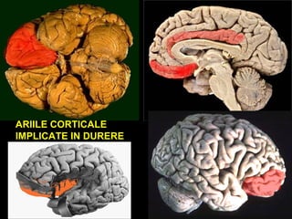 Atlas de neuroanatomie Calea durerii | PPT