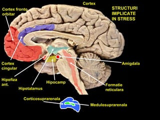 Atlas de neuroanatomie Calea durerii | PPT