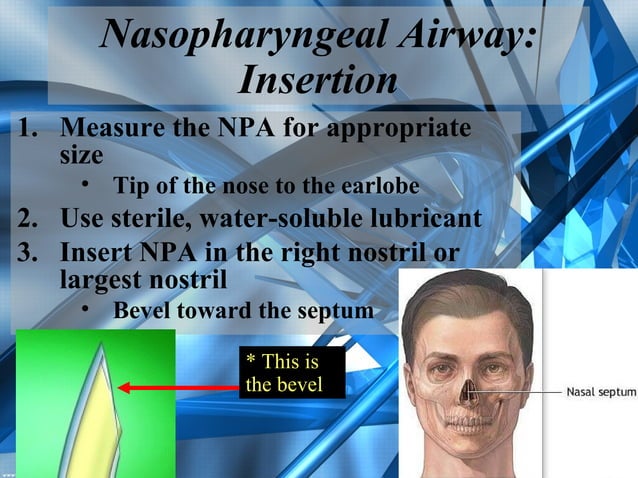 Airway Management | PPT