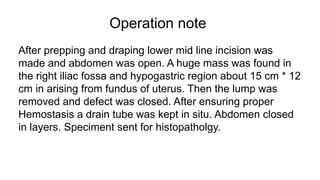 A 28 year old female patient with abdominal lump.pptx