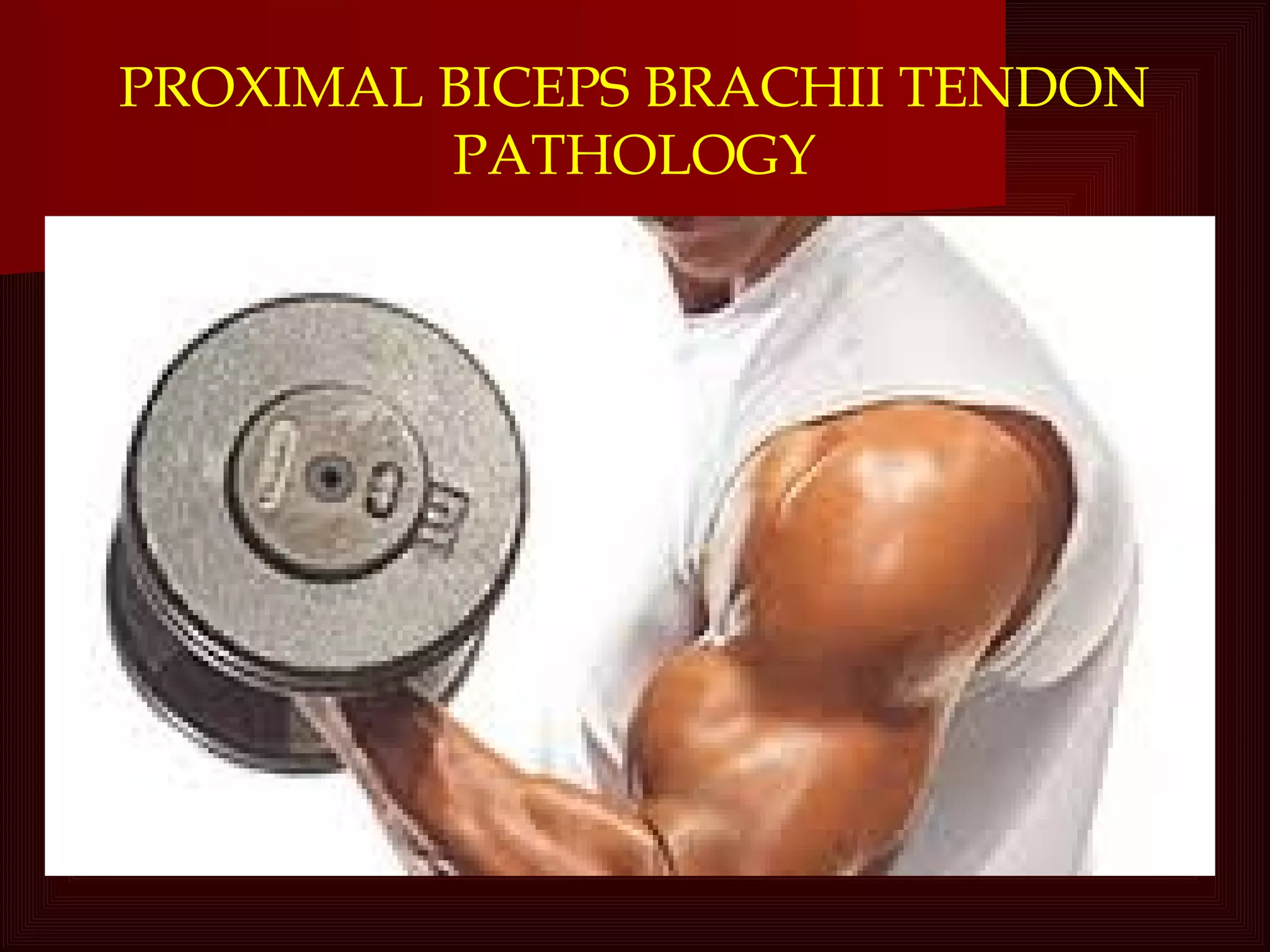 Biceps tendon pathology | PPT
