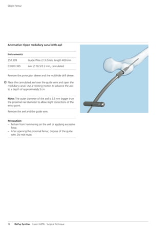 A2FN Synthes dsem trm-1015-0537-1-lr | PDF