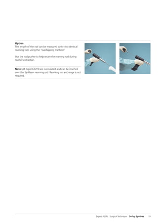 A2FN Synthes dsem trm-1015-0537-1-lr | PDF
