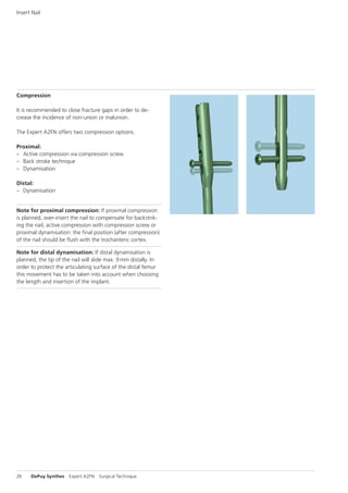 A2FN Synthes dsem trm-1015-0537-1-lr | PDF