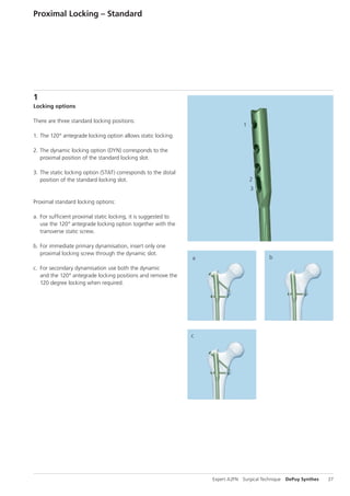 A2FN Synthes dsem trm-1015-0537-1-lr | PDF
