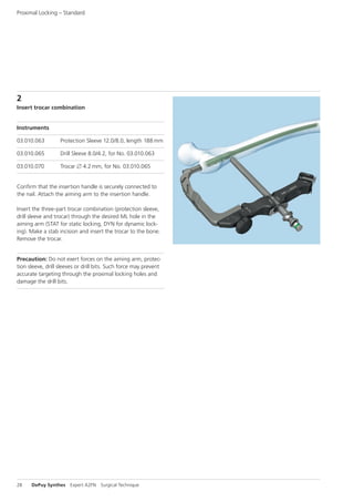 A2FN Synthes dsem trm-1015-0537-1-lr | PDF