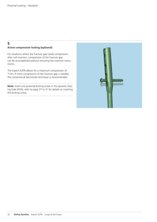 A2FN Synthes dsem trm-1015-0537-1-lr | PDF