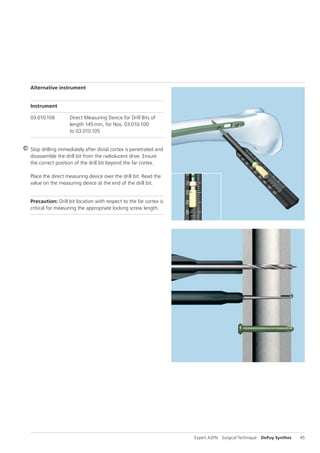 A2FN Synthes dsem trm-1015-0537-1-lr | PDF