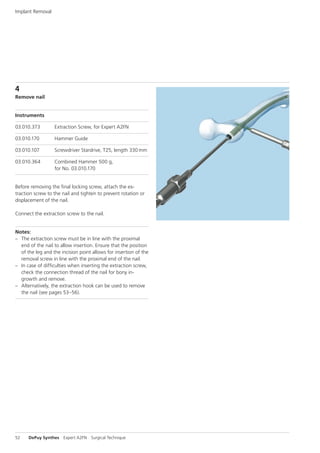 A2FN Synthes dsem trm-1015-0537-1-lr | PDF