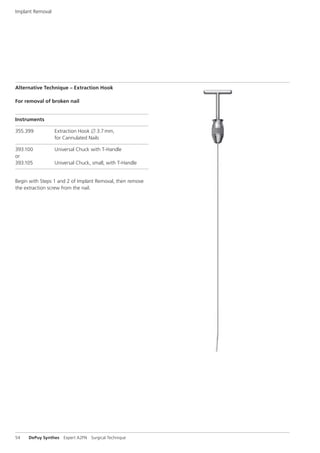 A2FN Synthes dsem trm-1015-0537-1-lr | PDF