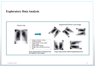 covid 19 detection using lung x-rays.pptx.pptx