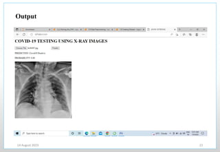 covid 19 detection using lung x-rays.pptx.pptx