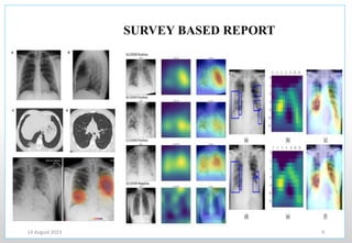 covid 19 detection using lung x-rays.pptx.pptx