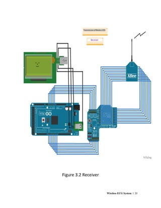 Wireless ECG System | PDF