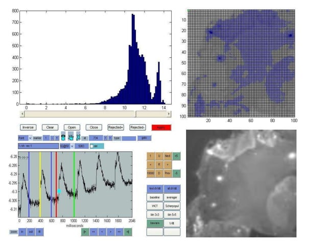 ICU case presentation-english 2016 | PPTX | Medical Health