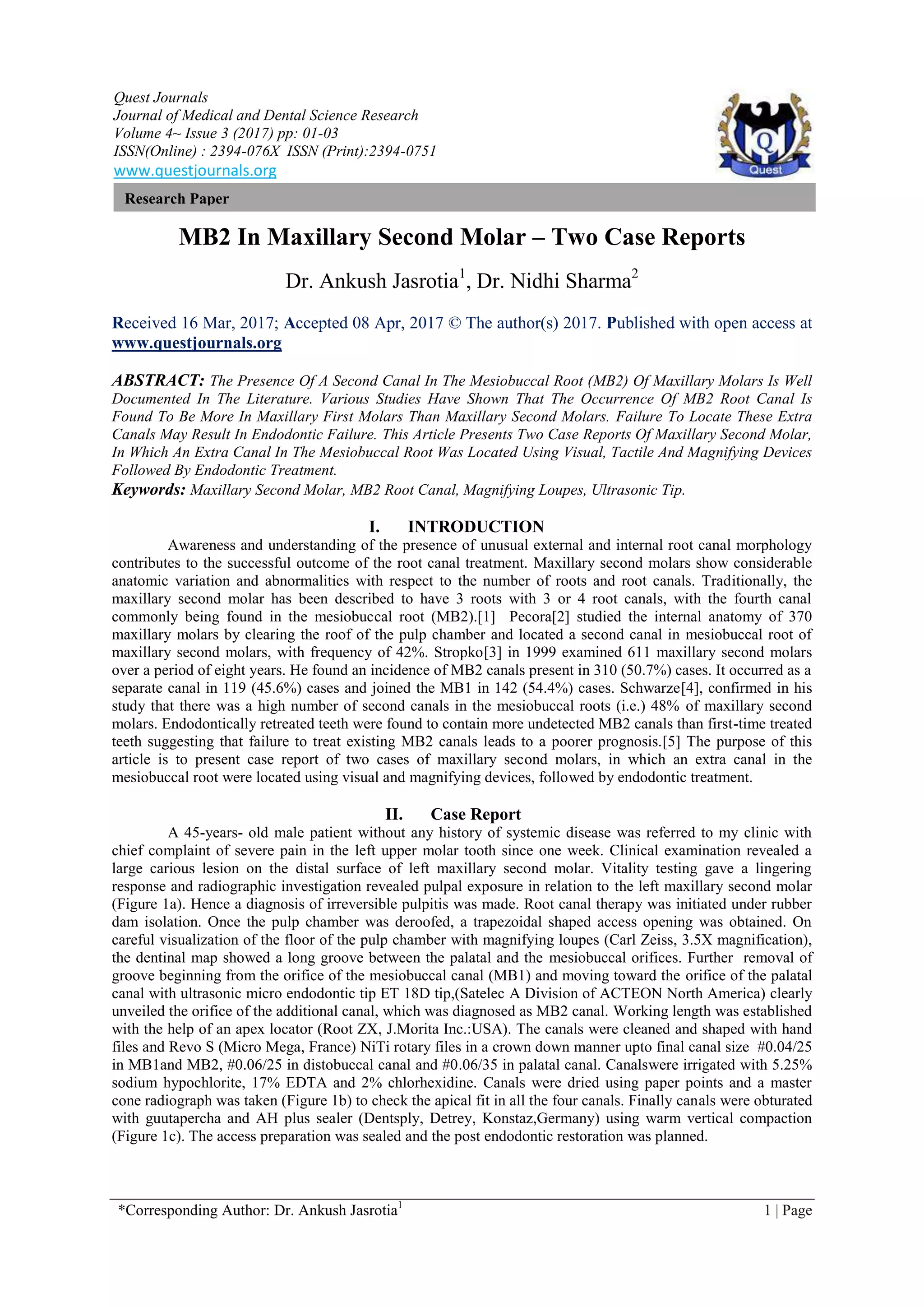 MB2 In Maxillary Second Molar – Two Case Reports | PDF