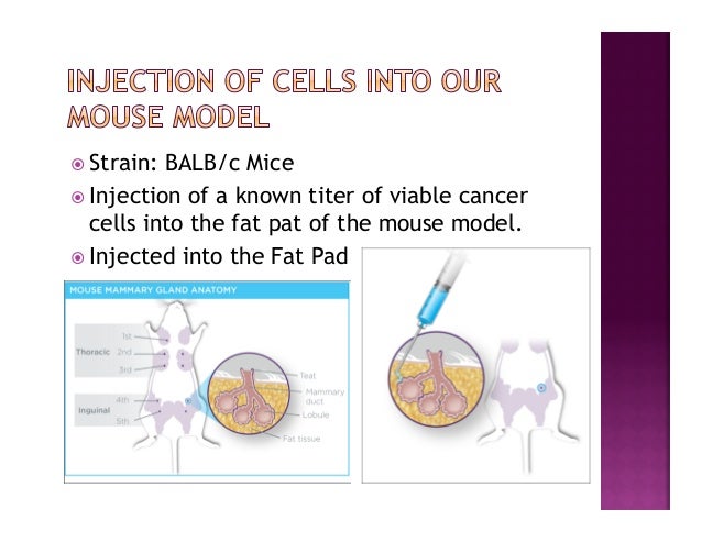 Metastatic Breast Cancer