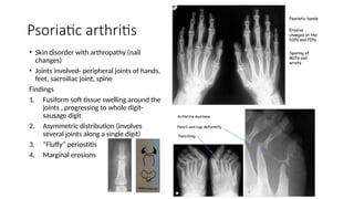 Joints indications and interpret plain.pptx