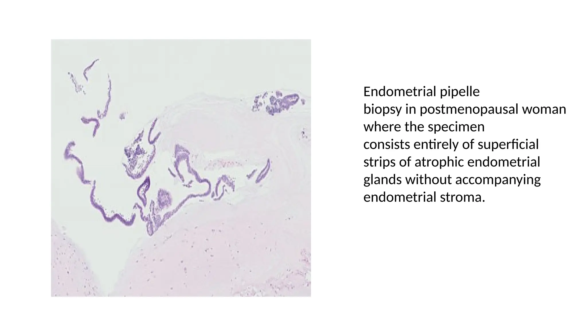 Endometrial biopsy_ interpretation .pptx