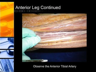 Anterior Tibial Artery Cadaver