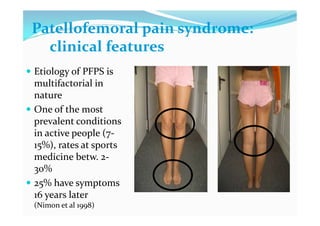 Albasini jfk2011 | PDF | Foot Health | Diseases and Conditions