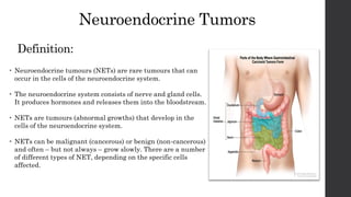 Neuroendocrine disorder( quick review lecture) .pdf