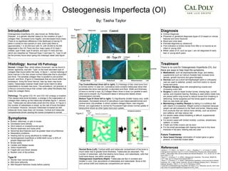 Osteogenesis Imperfecta (OI) | PDF