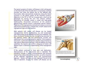 Upper limb | PDF